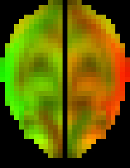 Ji Lab » Traumatic brain injury